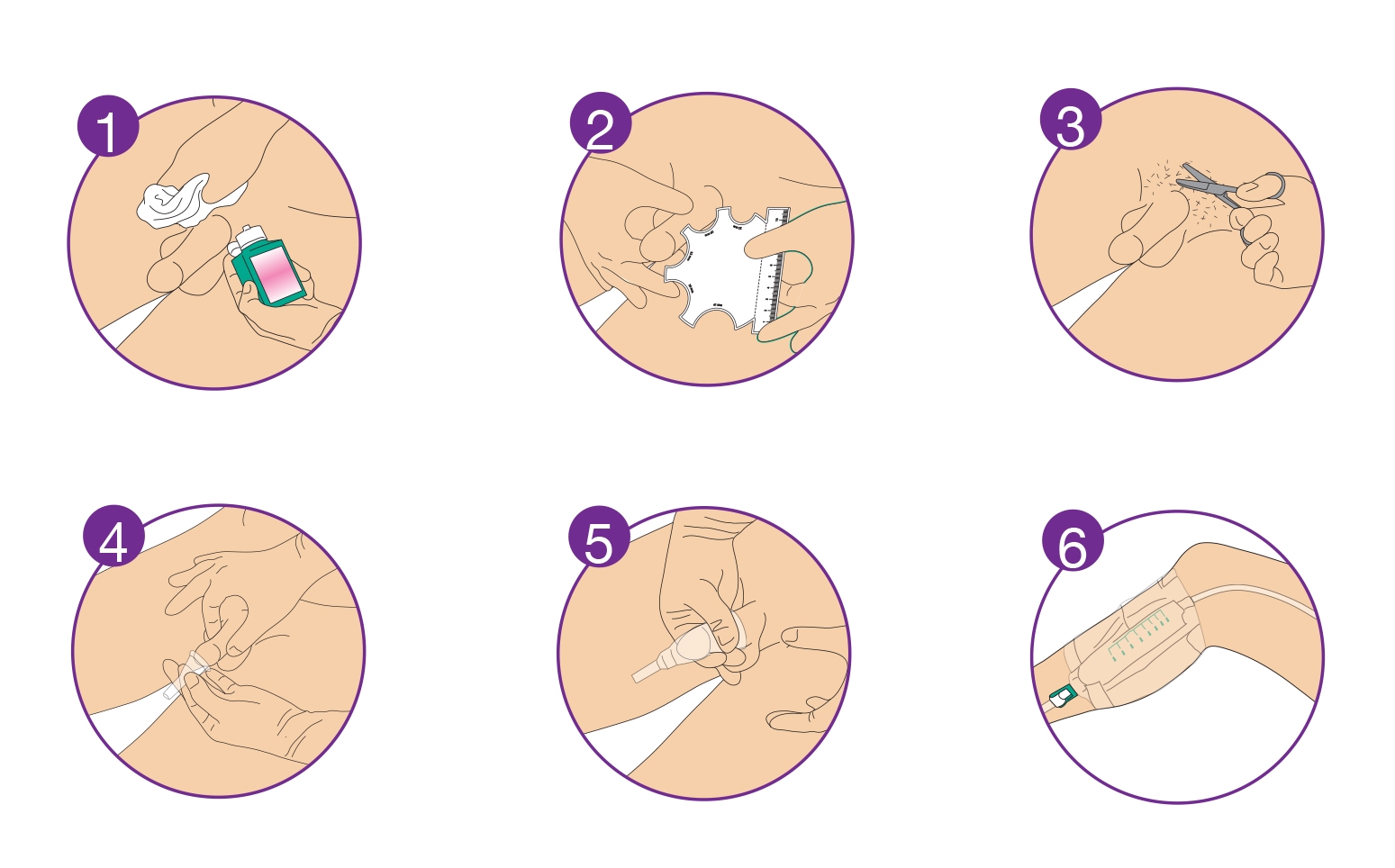 Comment appliquer l'étui pénien ? - B. Braun