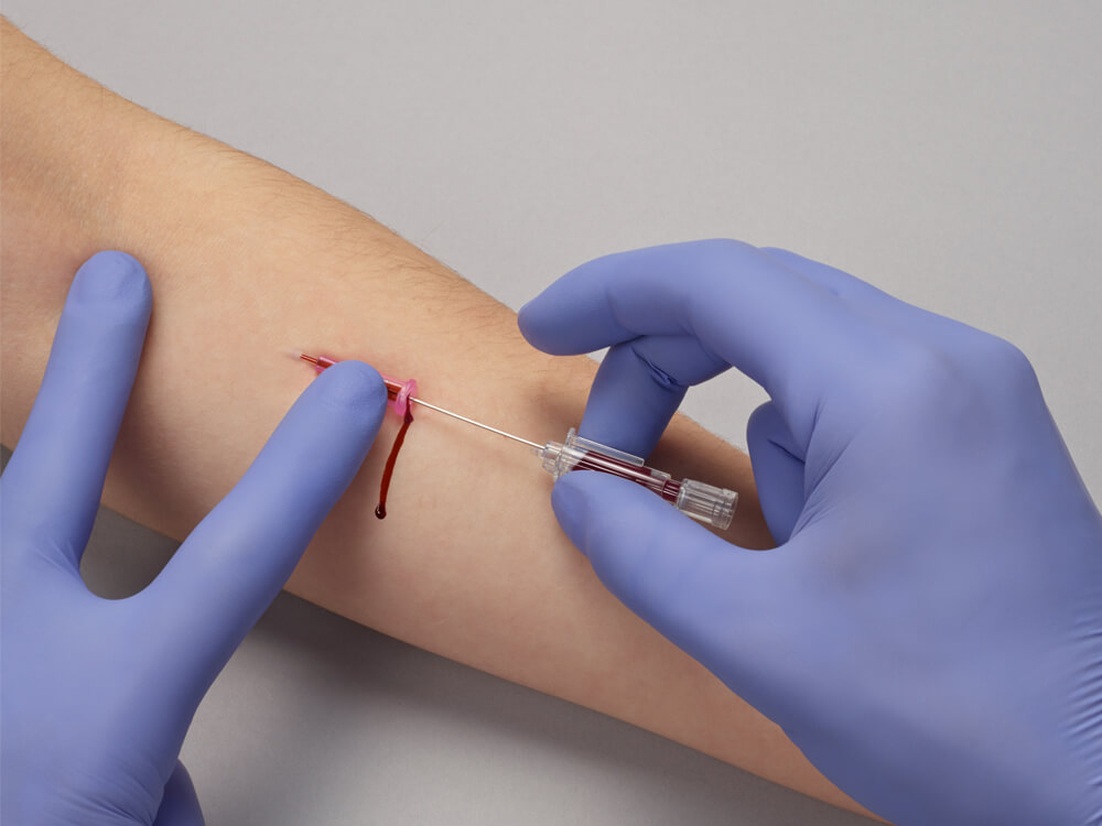 Voorkomen van bloedlekkage en blootstelling aan bloed - B. Braun