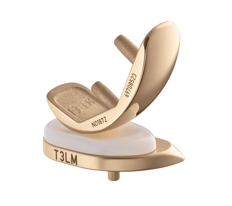 Univation® X Unicondylar Knee Arthroplasty System