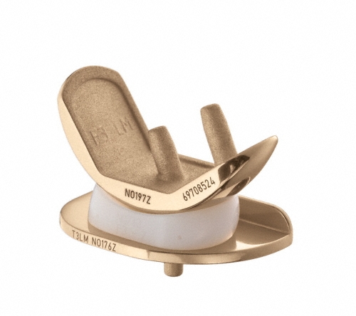 Univation® X Unicondylar Knee Arthroplasty System